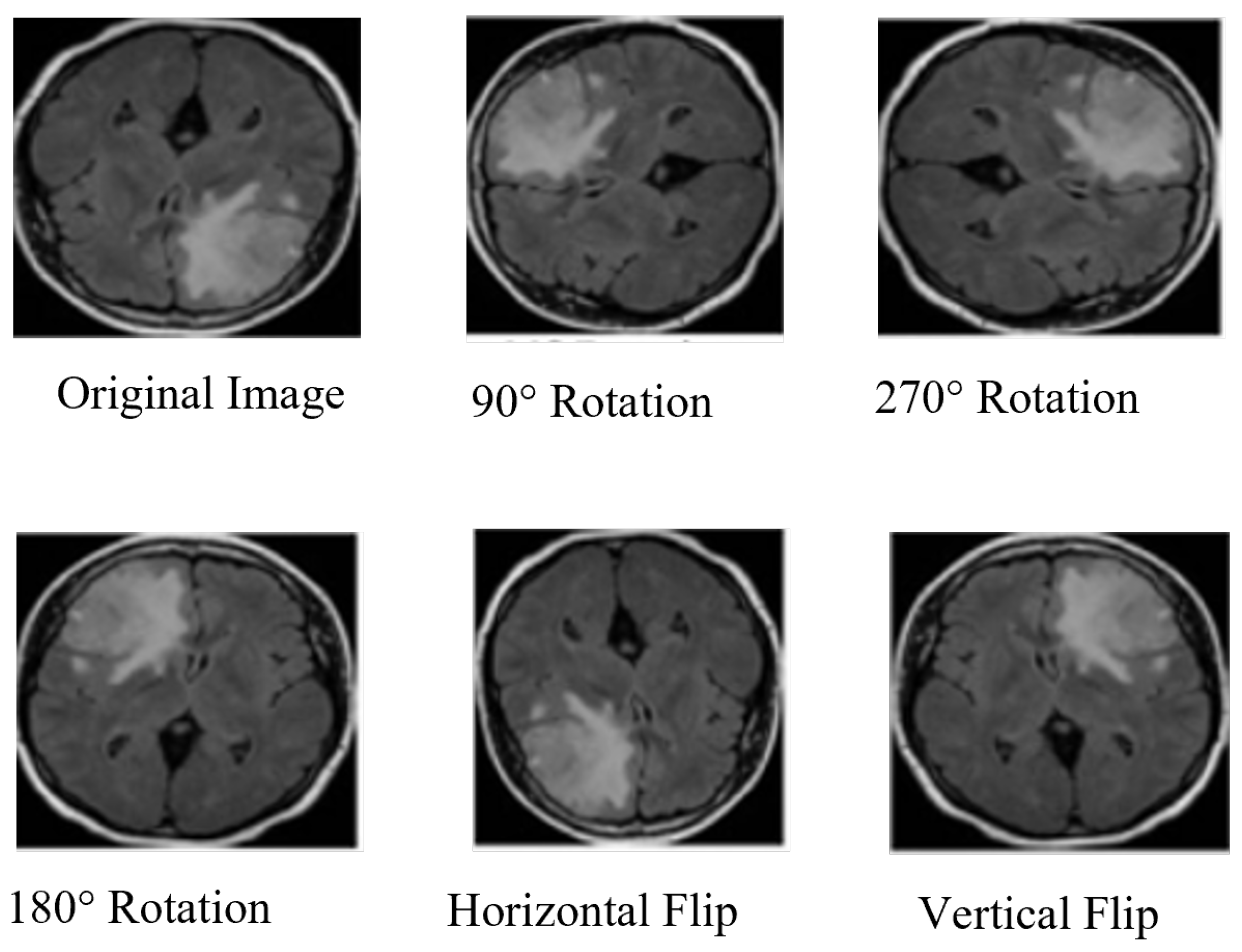 Explainable Deep Learning Approach for Multi-Class Brain Magnetic Resonance Imaging Tumor ...