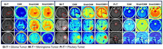 Explainable Deep Learning Approach for Multi-Class Brain Magnetic ...