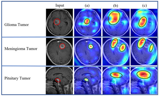 Explainable Deep Learning Approach for Multi-Class Brain Magnetic Resonance Imaging Tumor ...