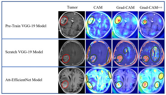 Explainable Deep Learning Approach for Multi-Class Brain Magnetic ...