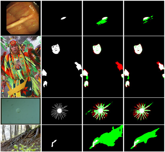 Exploring the Potential of Ensembles of Deep Learning Networks for Image Segmentation