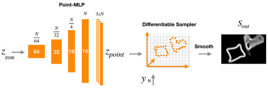 Shape Matters: Detecting Vertebral Fractures Using Differentiable Point ...