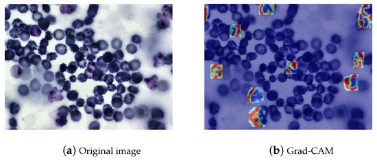 Multi-Level Attention Split Network: A Novel Malaria Cell Detection Algorithm