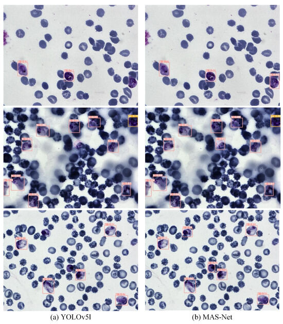 Information | Free Full-Text | Multi-Level Attention Split Network: A Novel Malaria Cell ...