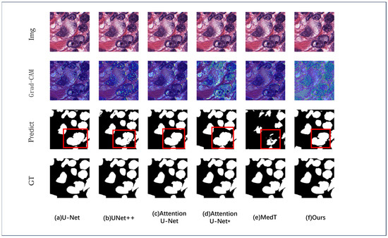 Edge-Guided Cell Segmentation on Small Datasets Using an Attention-Enhanced U-Net Architecture