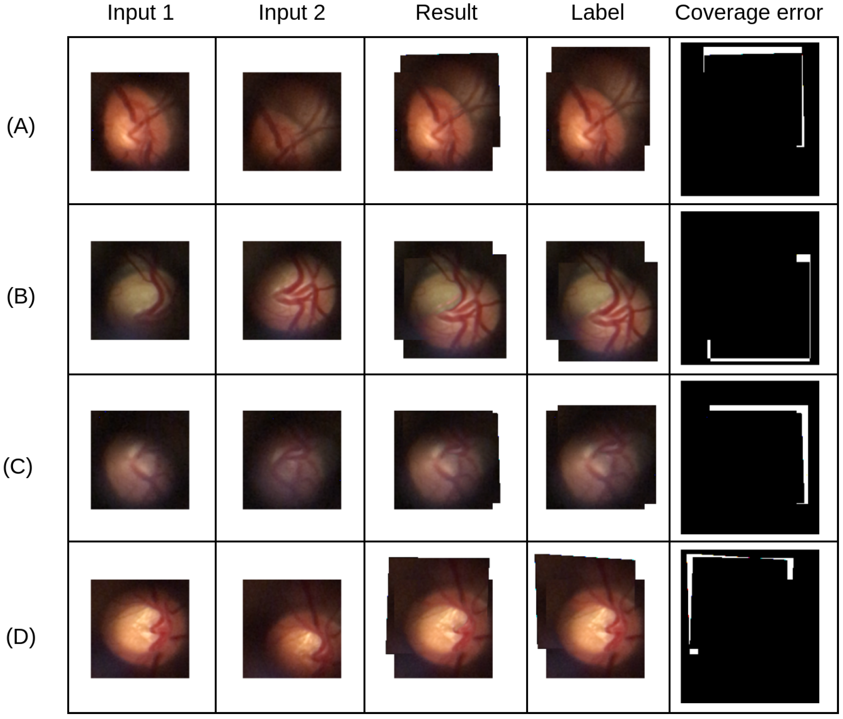 Image Stitching of Low-Resolution Retinography Using Fundus Blur Filter and Homography ...