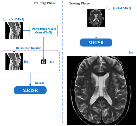 MRI Super-Resolution Analysis via MRISR: Deep Learning for Low-Field ...