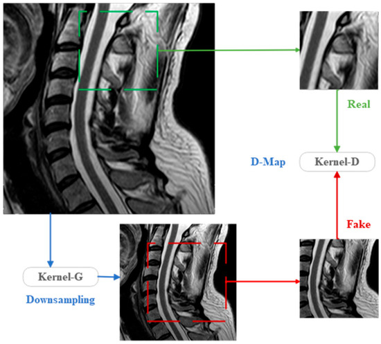 MRI Super-Resolution Analysis via MRISR: Deep Learning for Low-Field Imaging
