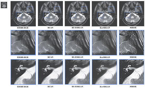 MRI Super-Resolution Analysis via MRISR: Deep Learning for Low-Field Imaging