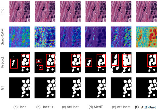 A Lightweight Neural Network for Cell Segmentation Based on Attention Enhancement