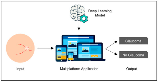 Hybrid Deep Learning Model for Improved Glaucoma Diagnostic Accuracy