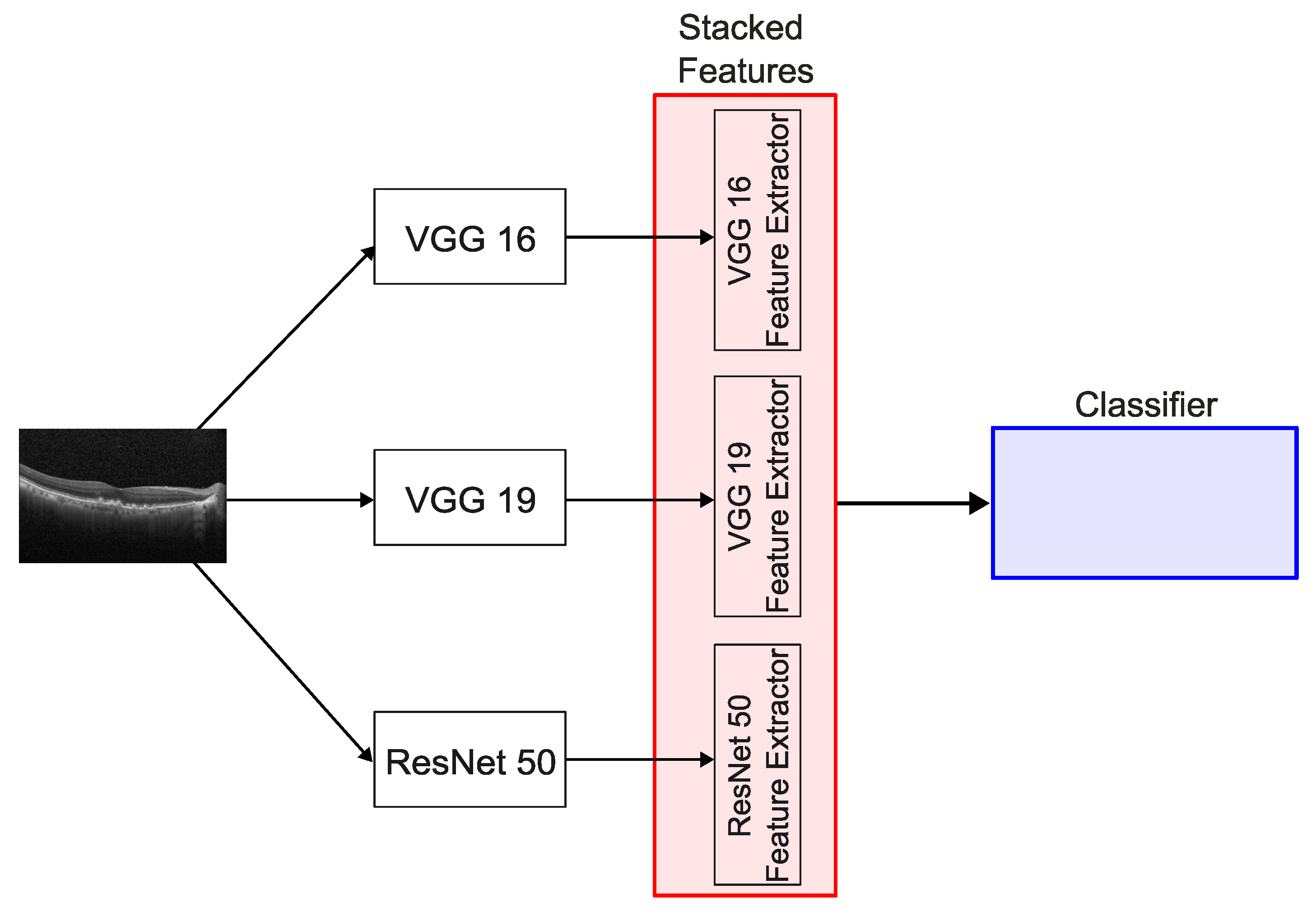 Development of Stacked Neural Networks for Application with OCT Data ...
