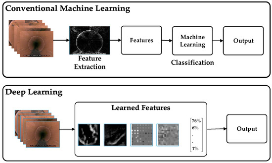 Review on Computer Aided Sewer Pipeline Defect Detection and Condition ...