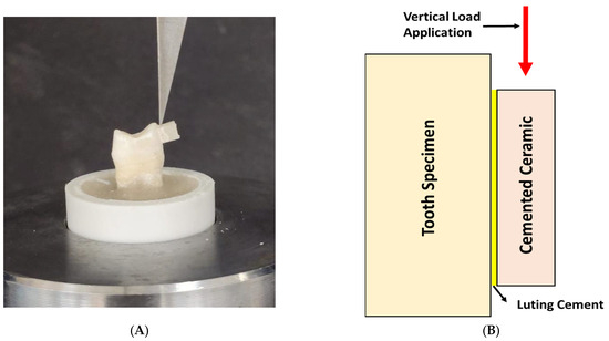 Effect of Self-Adhesive Resin Cement Film Thickness on the Shear Bond ...