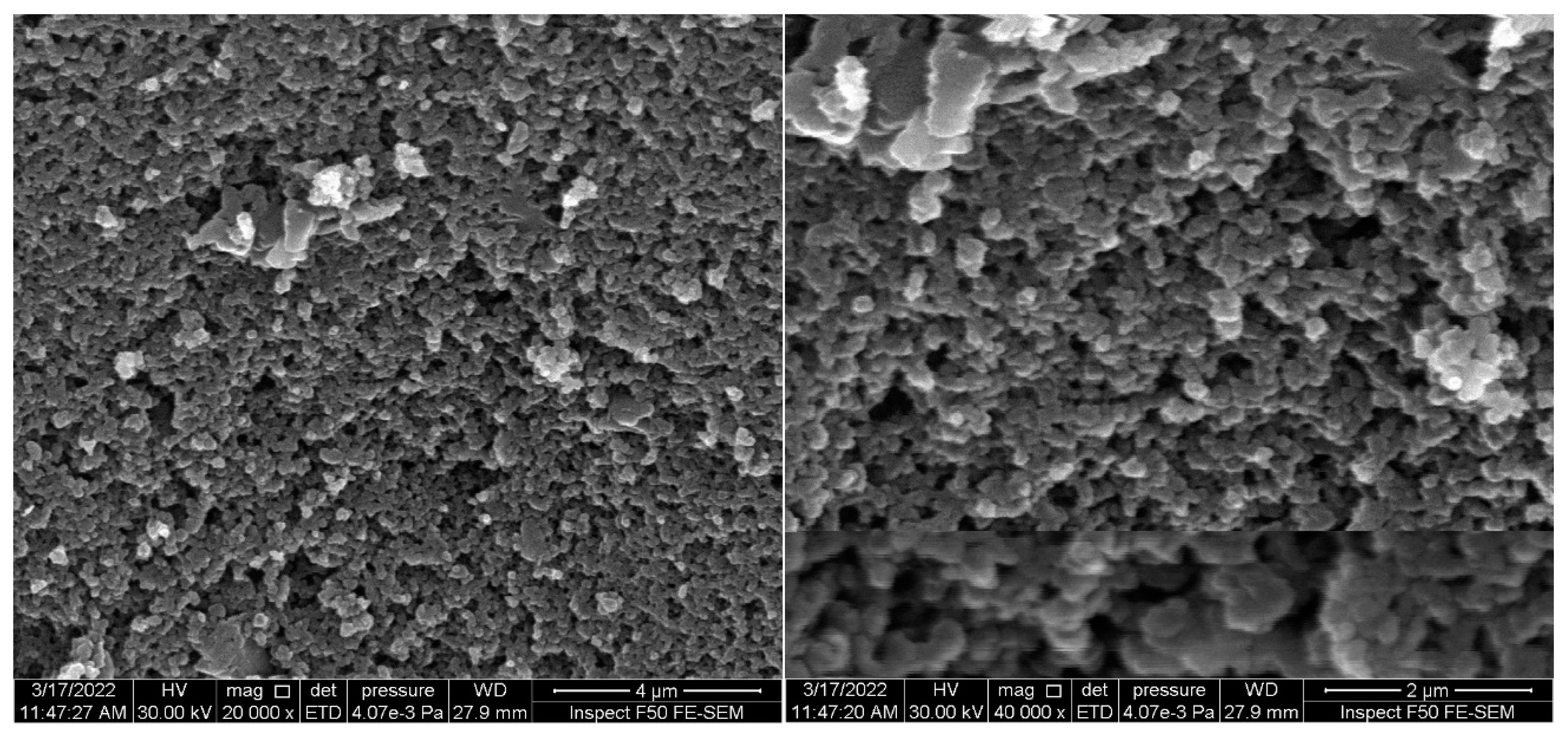 Biosynthesized ZnO-CuO Nanocomposite for Biofilm Formation of Proteus ...