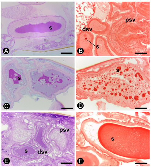 A Glycoproteinaceous Secretion in the Seminal Vesicles of the Termite ...