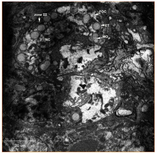 Morphology of the Female Reproductive System of the Soybean Thrips ...