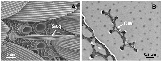 Ultrastructure Characteristics and Sexual Dimorphism of Antennal ...