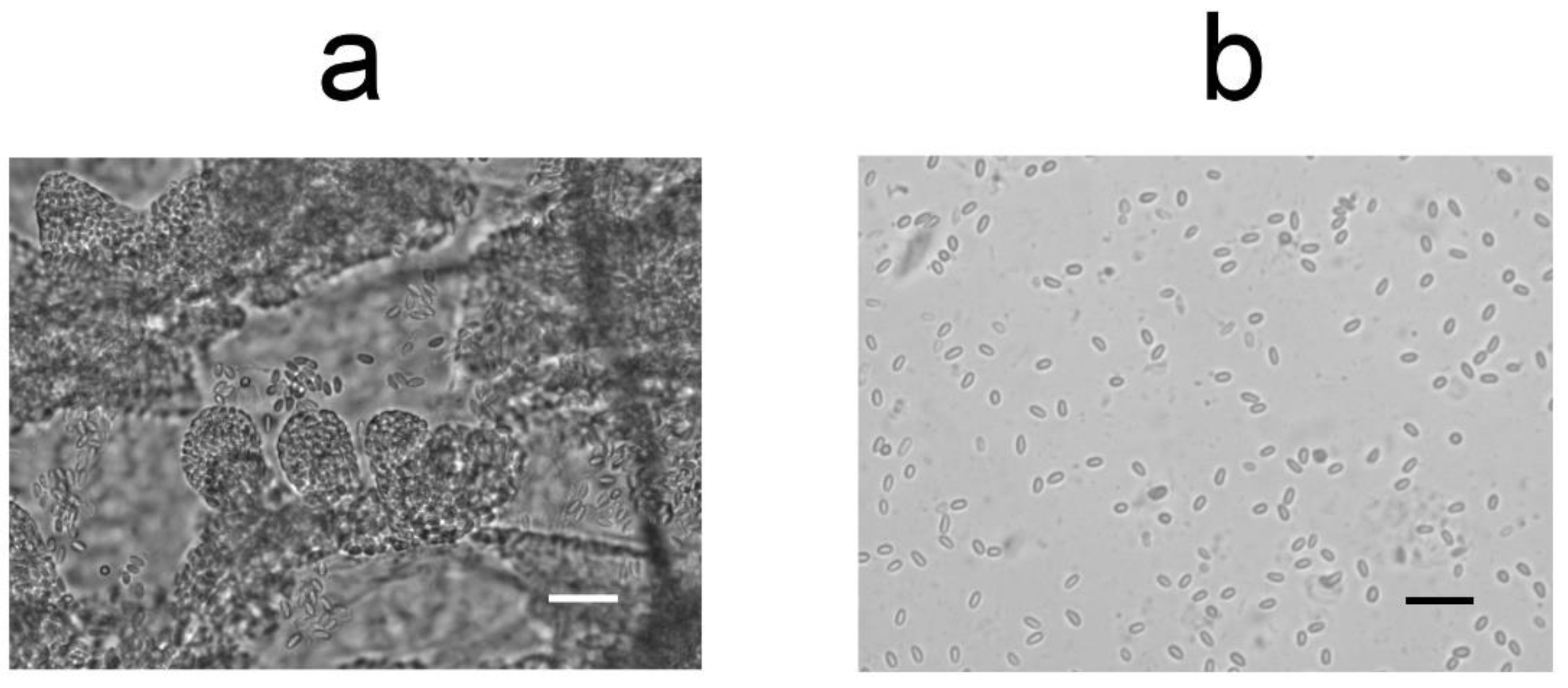 Laboratory Cultivation of Vairimorpha (Nosema) ceranae (Microsporidia ...