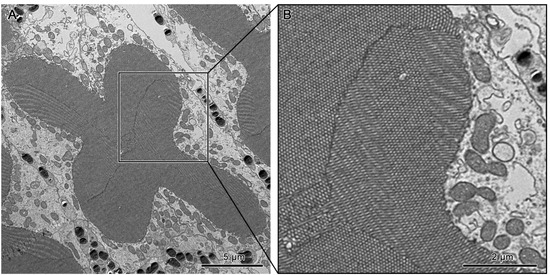Functional Anatomy of Split Compound Eyes of the Whirligig Beetles ...