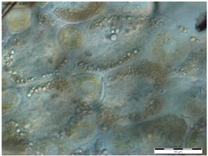 The Morphological Image of Fat Body and Tergal Gland Cells in ...