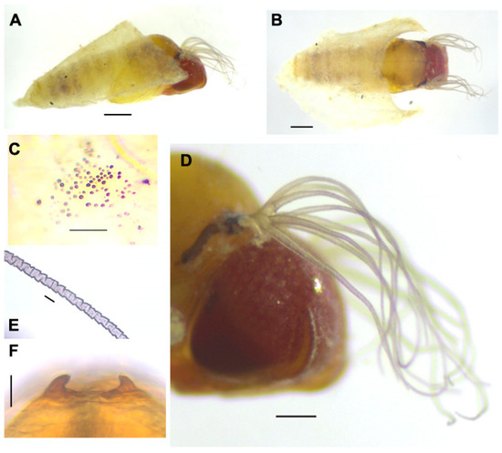 Discovery of the Larvae and Pupae of the Black Fly Simulium ...