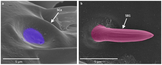 Report on the Types and Distribution of Antennal Sensilla in Lygaeidae ...
