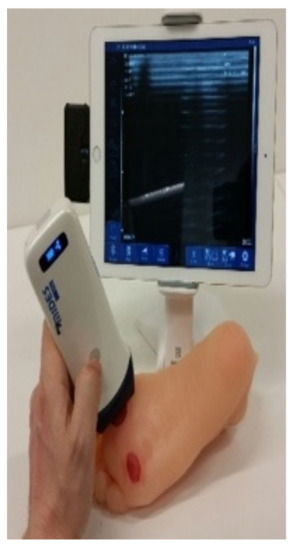 A Non-Invasive Photonics-Based Device for Monitoring of Diabetic Foot ...