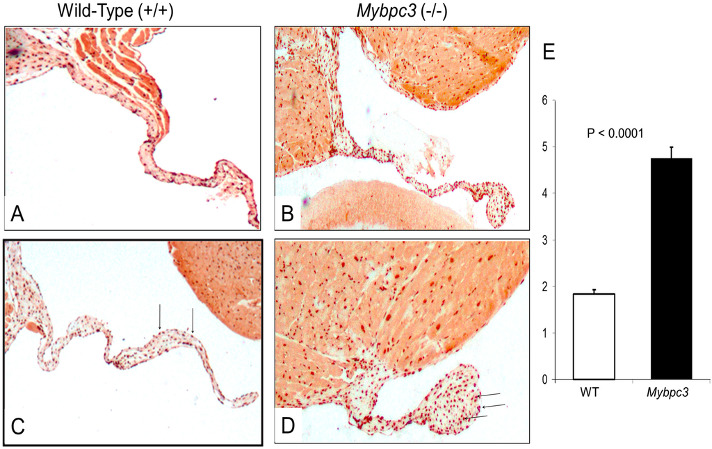 Targeted Mybpc3 Knock-Out Mice with Cardiac Hypertrophy Exhibit ...