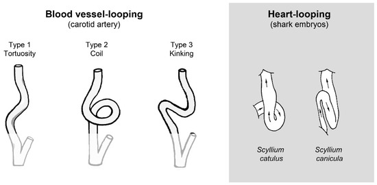 JCDD | Free Full-Text | Kinking and Torsion Can Significantly Improve ... JCDD | Free Full-Text | Kinking and Torsion Can Significantly Improve ...
