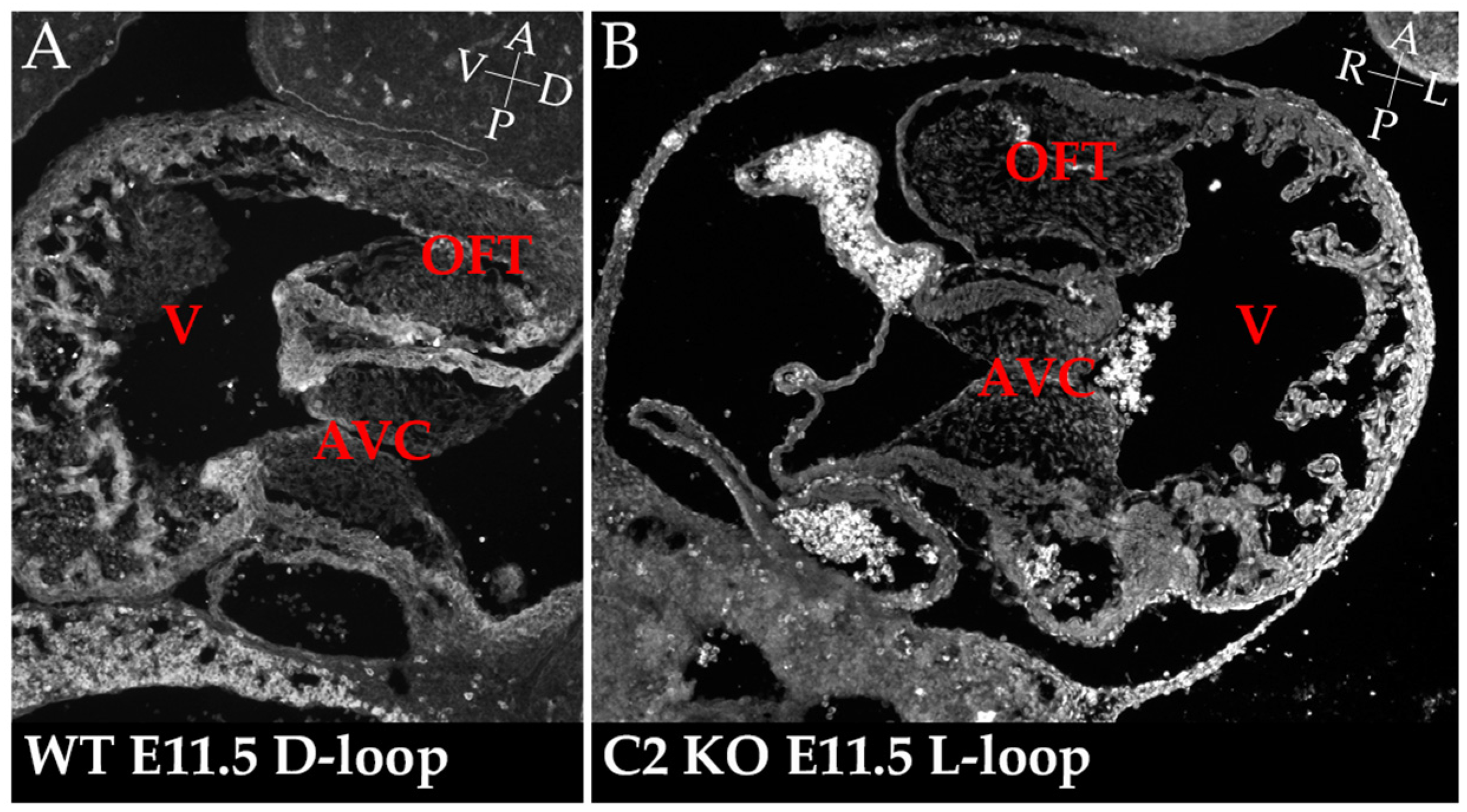 The Role of Cerl2 in the Establishment of Left-Right Asymmetries during ...