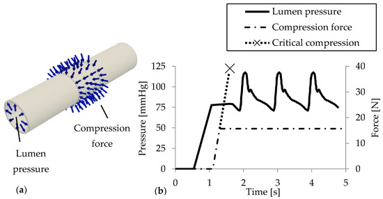Over-Wrapping of the Aortic Wall with an Elastic Extra-Aortic Wrap ...