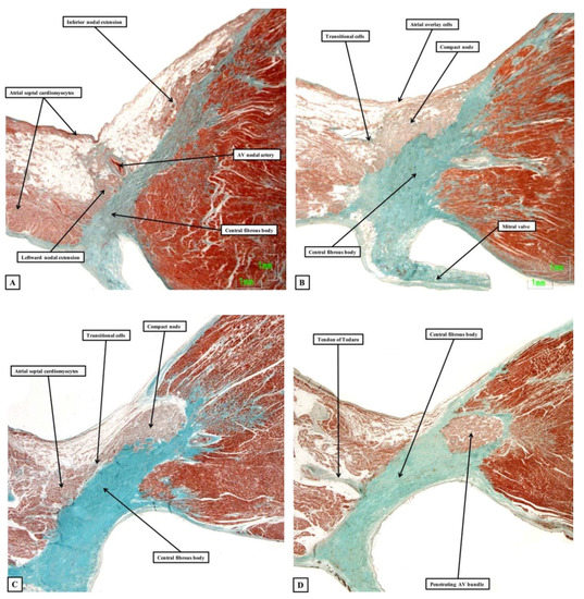 The Anatomy, Development, and Evolution of the Atrioventricular ...