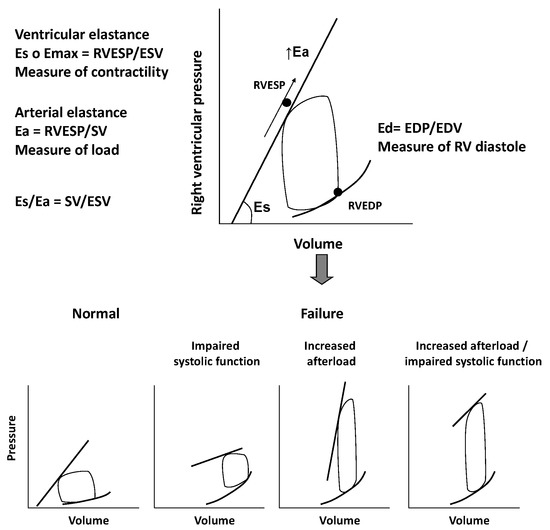Right Ventricular Function in Chronic Heart Failure: From the Diagnosis ...