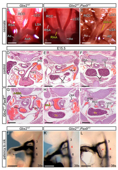 Journal of Cardiovascular Development and Disease | Editor's choice