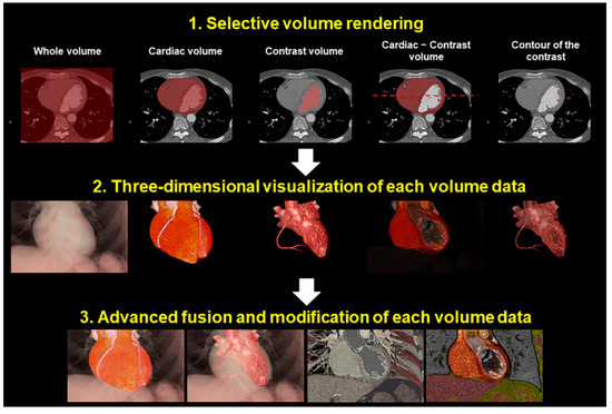 JCDD | Free Full-Text | Virtual Dissection: Emerging as the Gold ...