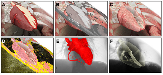 JCDD | Free Full-Text | Virtual Dissection: Emerging as the Gold ...