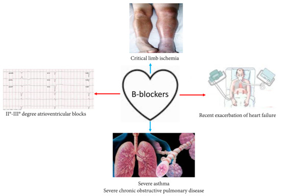 The Use of β-Blockers in Heart Failure with Reduced Ejection Fraction