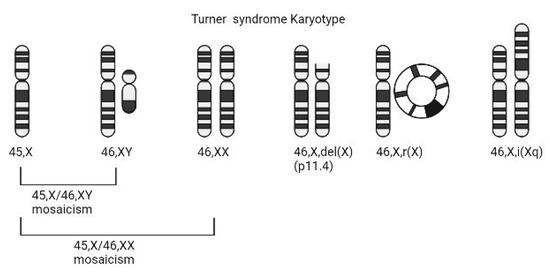 A Review of Recent Developments in Turner Syndrome Research