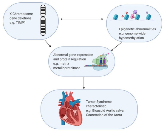 A Review of Recent Developments in Turner Syndrome Research