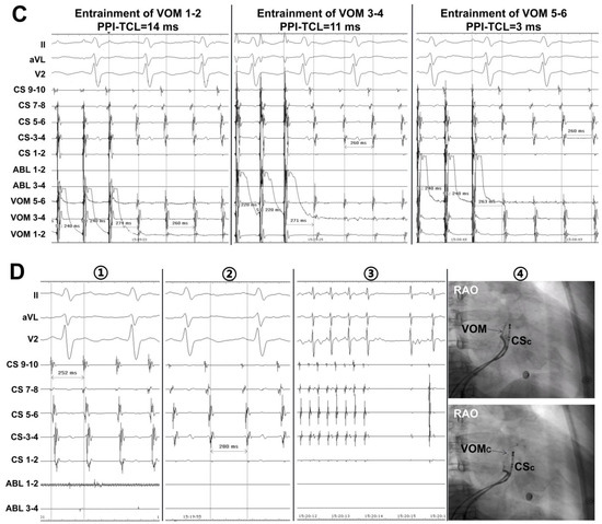 Journal of Cardiovascular Development and Disease | An Open Access ...