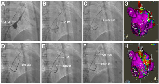 Journal of Cardiovascular Development and Disease | An Open Access ...