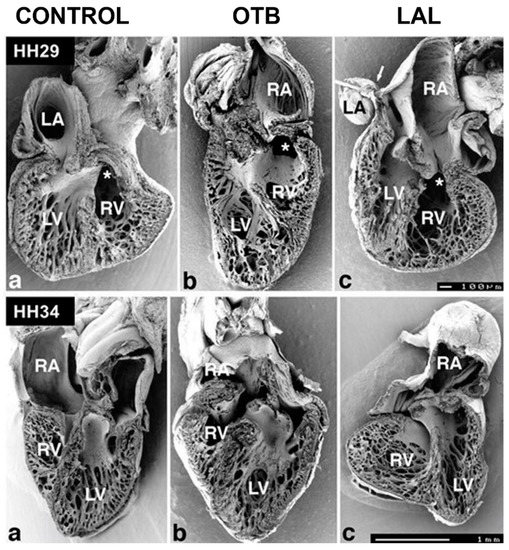 JCDD | Free Full-Text | Effect of Blood Flow on Cardiac Morphogenesis ...