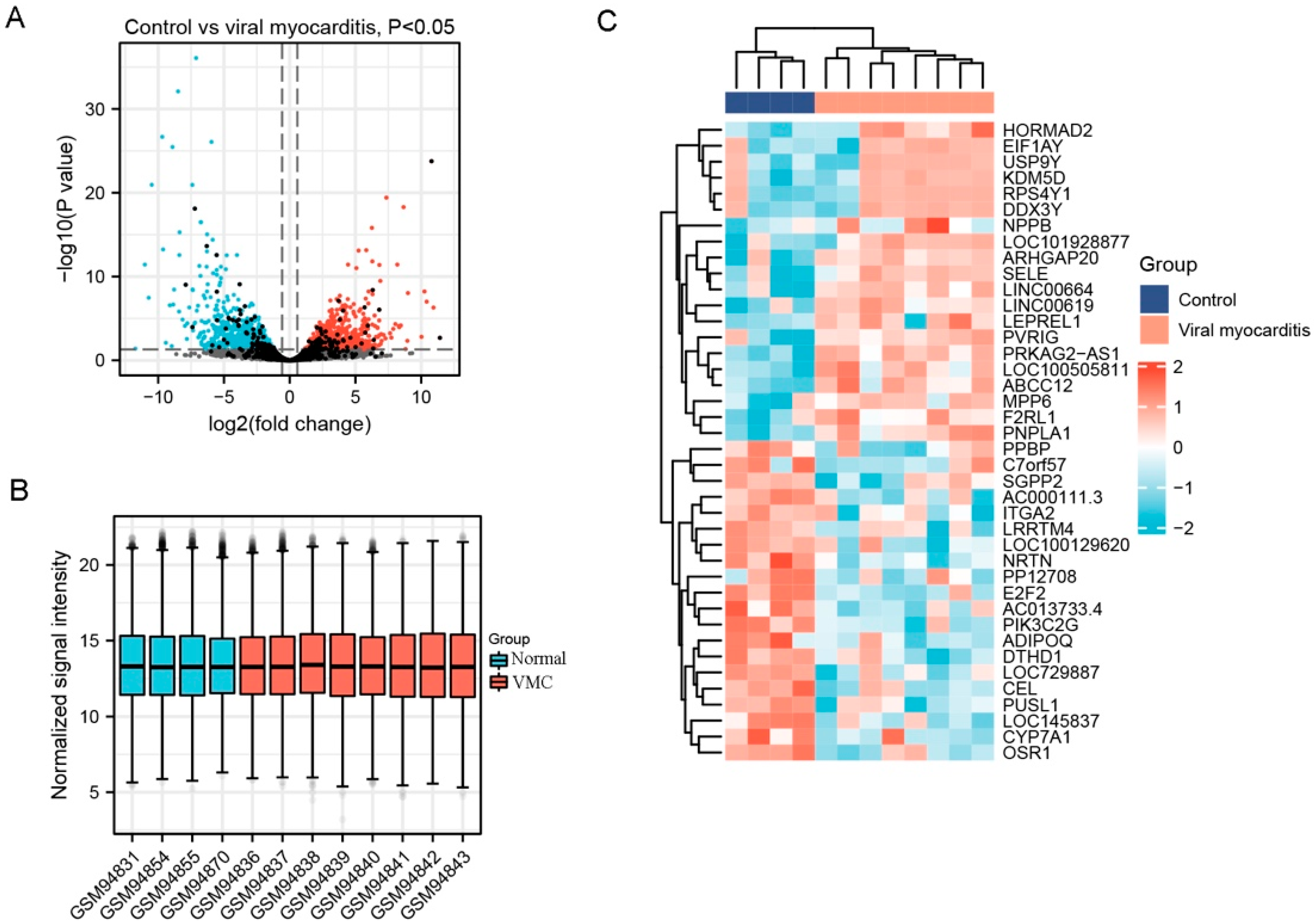 Bioinformatics Analysis of Common Differential Genes of Viral Myocarditis and Dilated ...