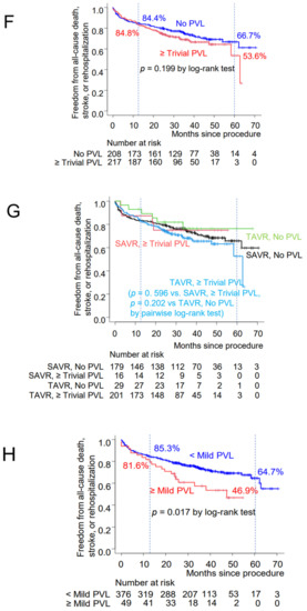 Prosthetic Valve Function after Aortic Valve Replacement for Severe ...