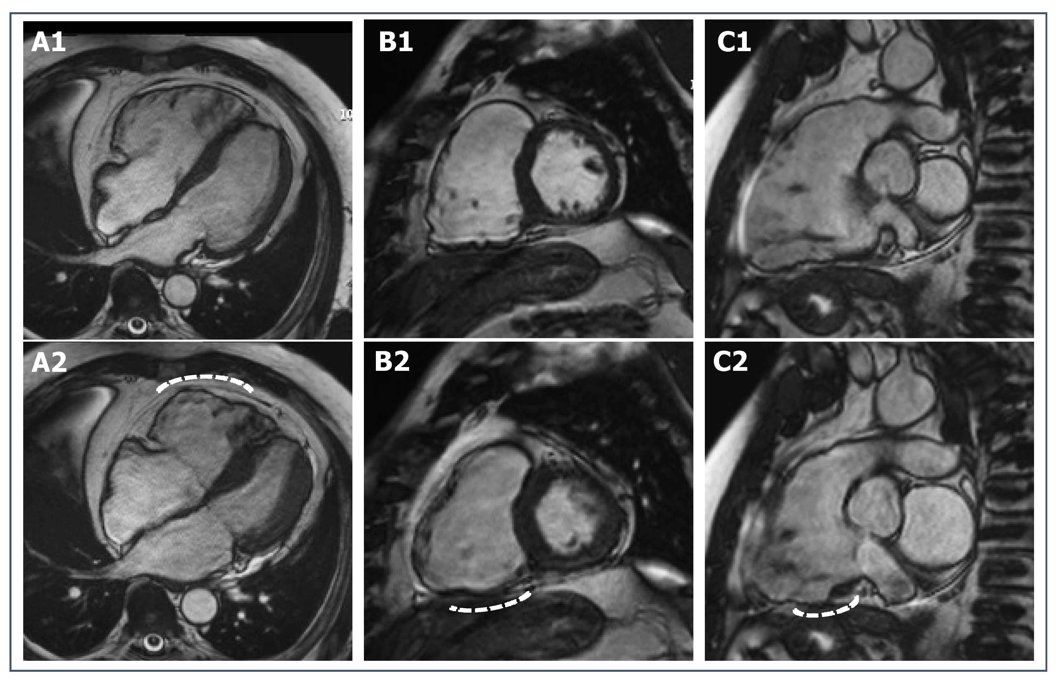 Certainties and Uncertainties of Cardiac Magnetic Resonance Imaging in ...