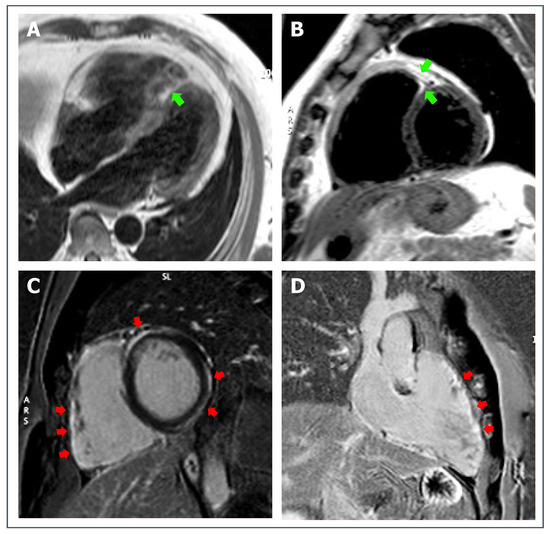 Journal of Cardiovascular Development and Disease | An Open Access ...