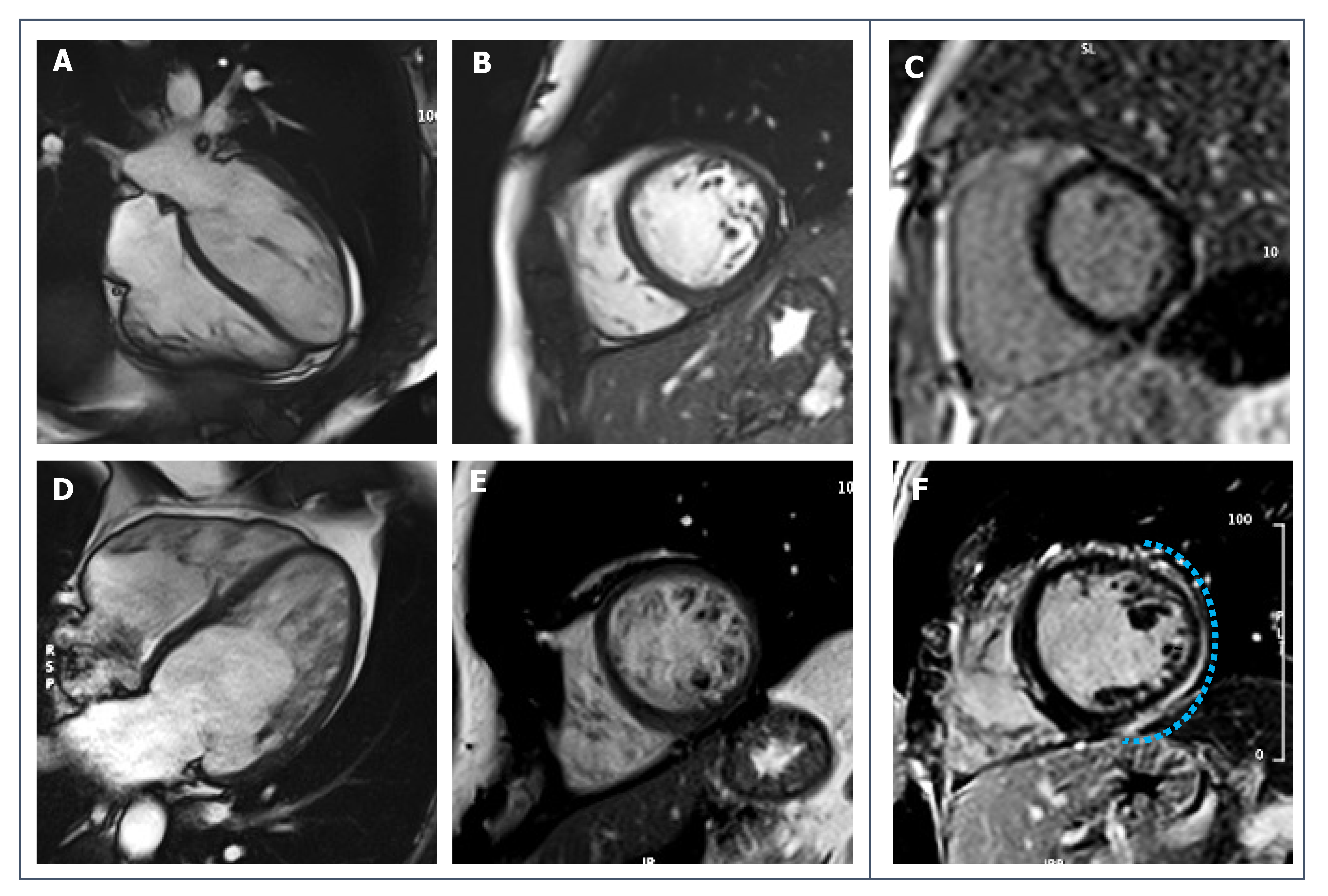 Certainties and Uncertainties of Cardiac Magnetic Resonance Imaging in ...