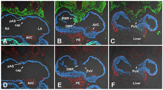 Sox9 Expression in the Second Heart Field; A Morphological Assessment ...