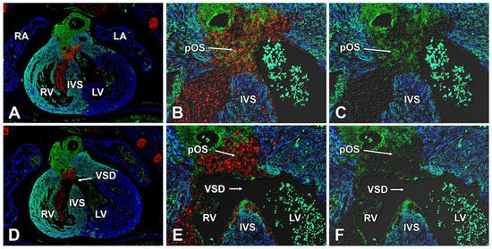Sox9 Expression in the Second Heart Field; A Morphological Assessment ...